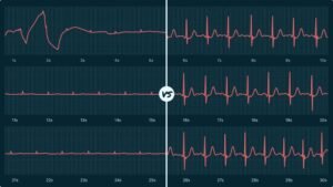 When to What is the Normal Voltage: Essential Guide for Safety ...